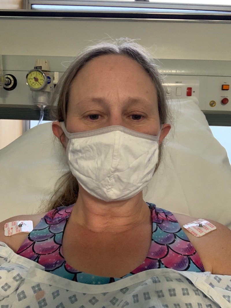 Extraction of Wisdom Teeth with Needle Phobia under General